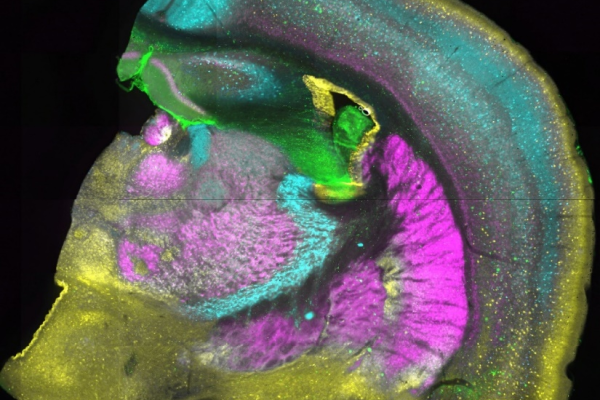 Research Clusters - Wolfson College